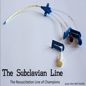 The Subclavian Line: the resuscitation line of champions | The DownEast ...